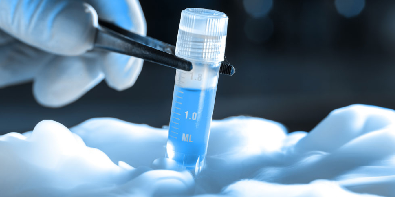 Semen Freezing (Semen Cryopreservation) - Slavica IVF & Research Center