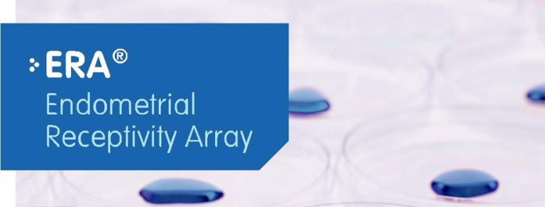 Endometrial Receptivity Testing (ERA) - Slavica IVF & Research Center